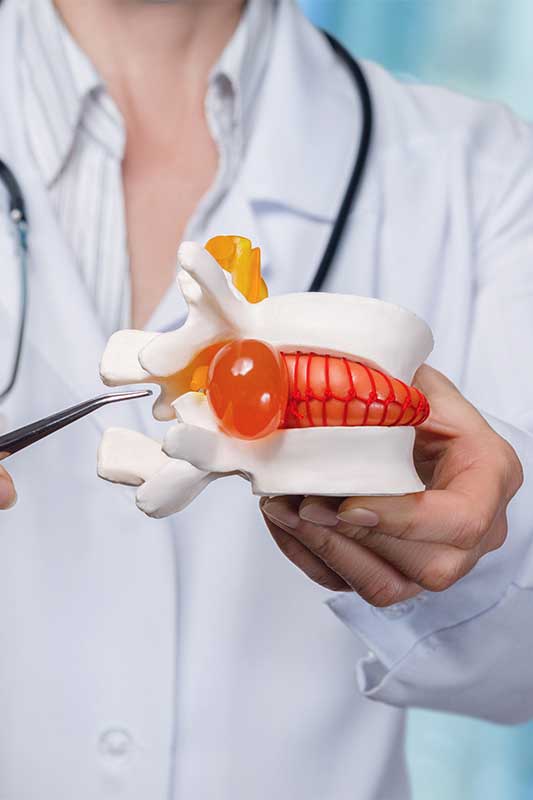 Herniated Disc | Mairaj Sami, MD